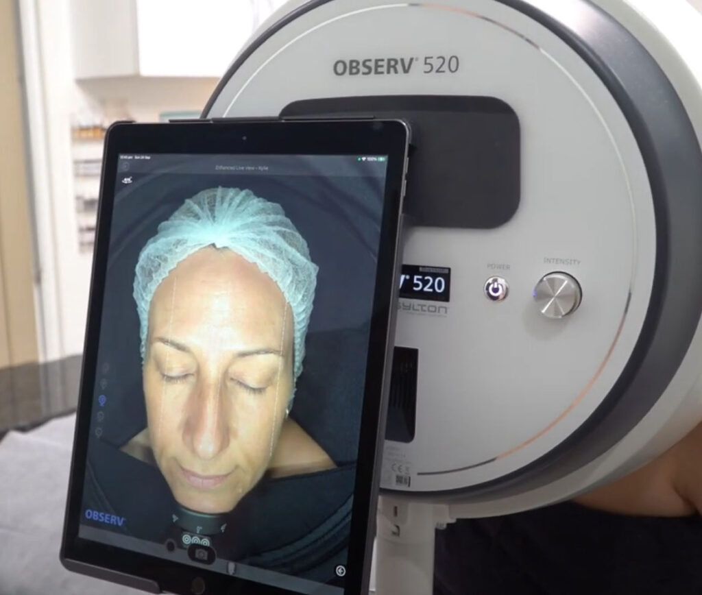 Skin Consultations | Diamond Medi Spa